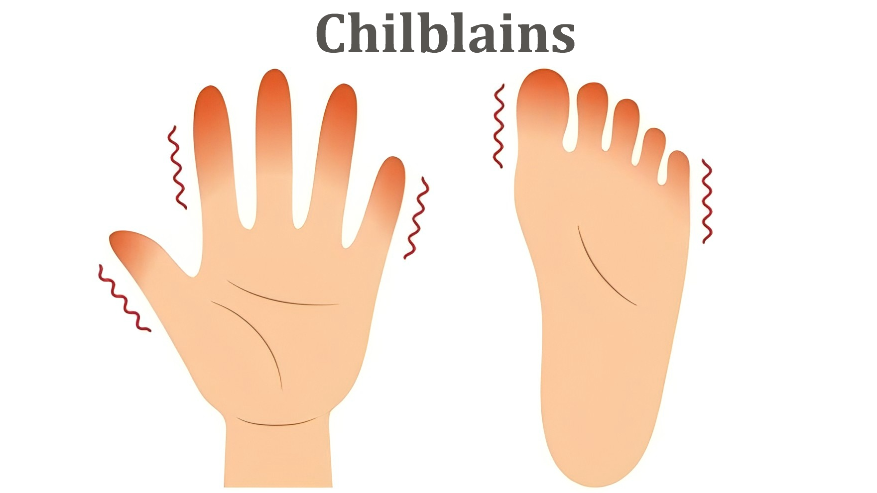 Can Dermatoscope Detect Chilblains? – IBOOLO