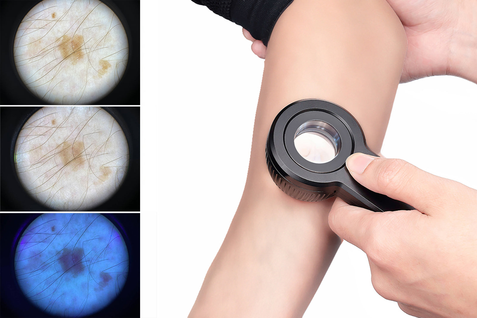 Cheap IBOOLO DE3100 Dermatoscope/Demoscopy for Dermatologist – IBOOLO