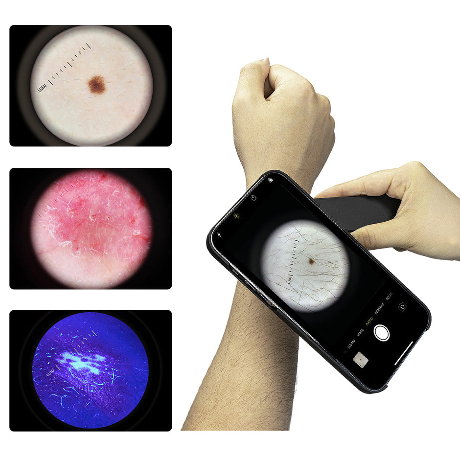 The world's best handheld dermoscope – IBOOLO